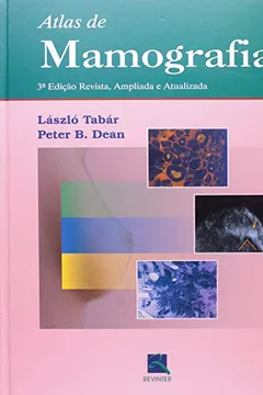 Atlas De Mamografia PDF Laszlo Tabar