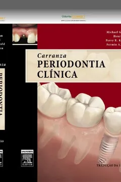Carranza Periodontia Clínica PDF Michael G. Newman