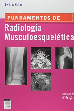 Fundamentos de Radiologia Musculoesquelética PDF Clyde A. Helms
