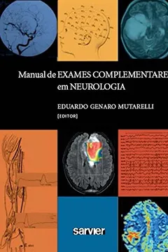 Manual De Exames Complementares Em Neurologia PDF Eduardo G. Mutarelli